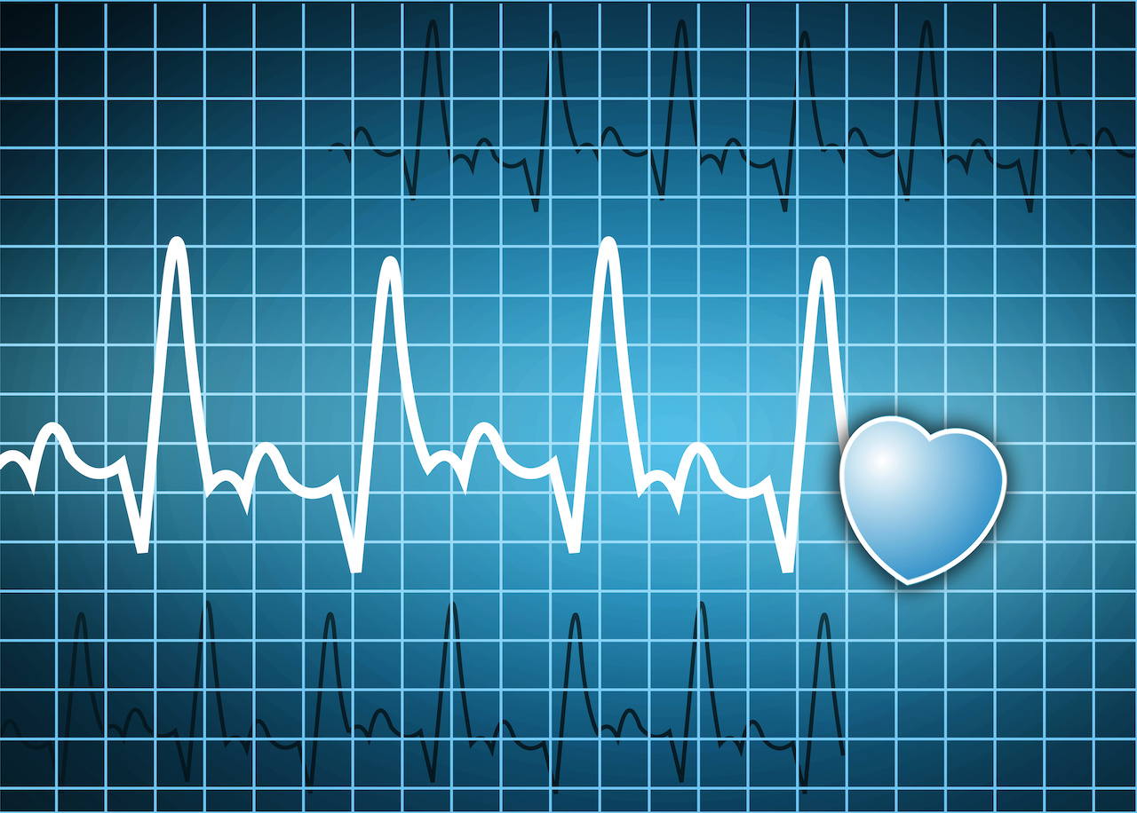 Ritmo cardiaco ¿Por qué es importante saber el suyo? - La Noticia