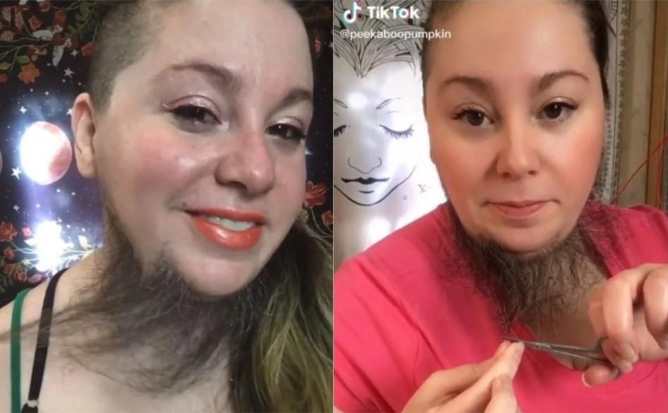 Mujer con barba se vuelve la sensación de OnlyFans - La Noticia