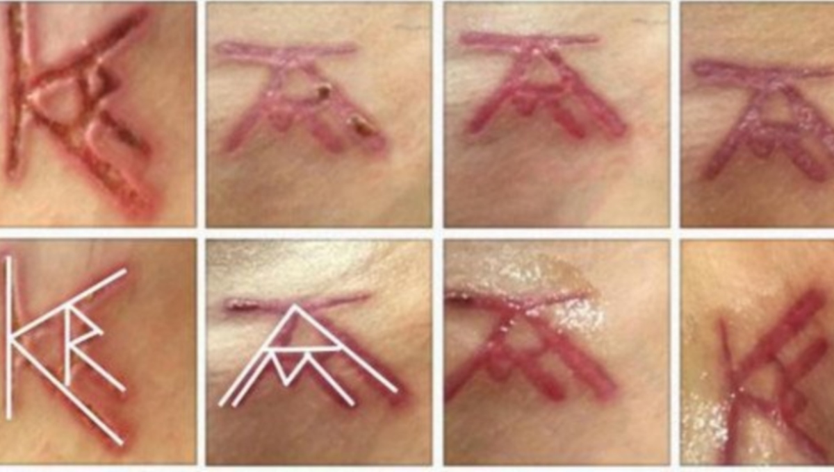 Revocan licencia a doctora de NXIVM que marcaba mujeres - La Noticia